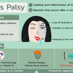 Bells Palsy - Neighbourly Massey, Auckland